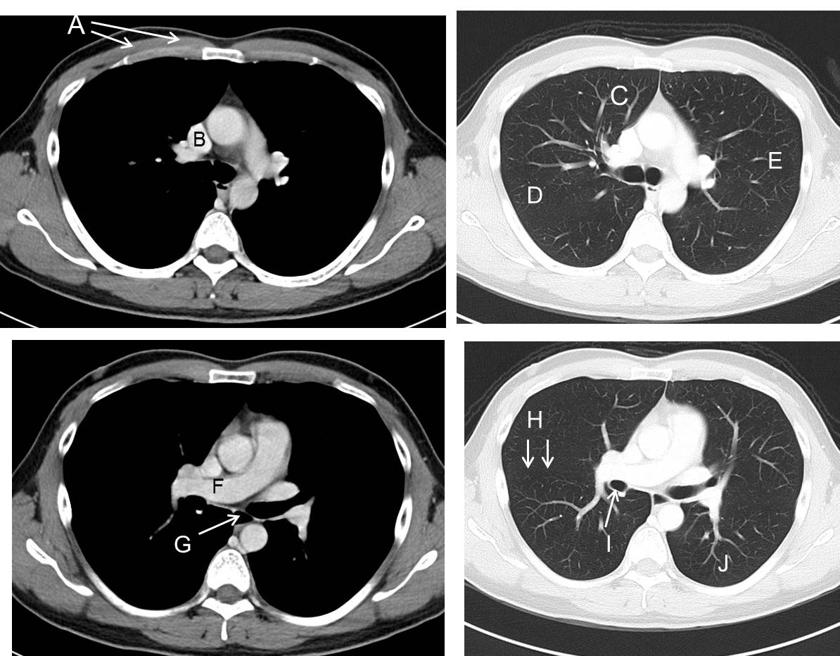 Quiz 18 – Radiology Cases Quiz 18 – Radiology Cases