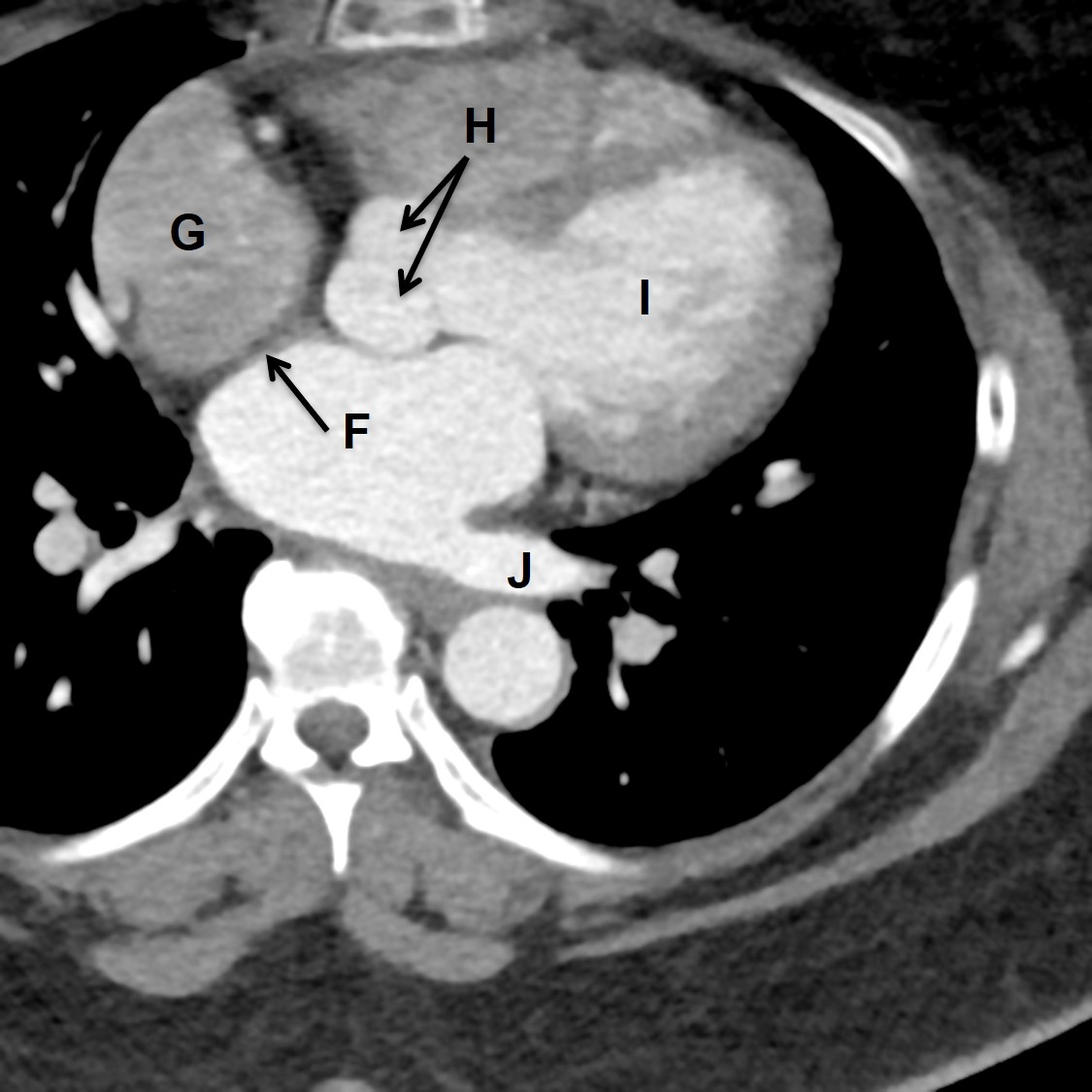 Quiz 30 Chest – Radiology Cases Quiz 30 Chest – Radiology Cases