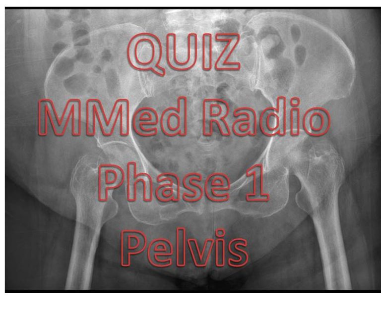 Quiz – Radiology Cases Quiz – Radiology Cases