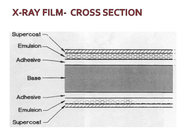 Year 4 MBBS: Principles of X-Ray Diagnosis – Radiology Cases